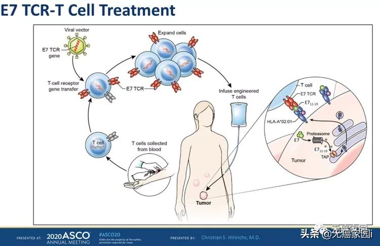 TCR-T therapy suddenly emerges!"Leader" who challenged solid tumors ...