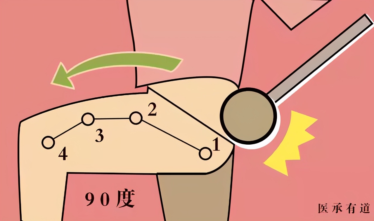 The liver is good, look at the root of the middle finger - iMedia