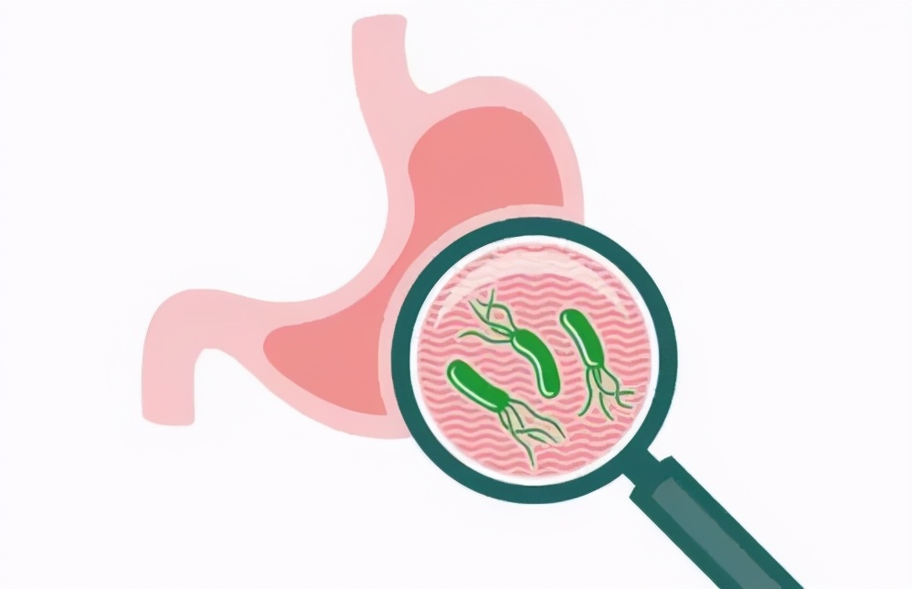 To treat Helicobacter pylori infection?"Quadruple Therapy" is worth a ...