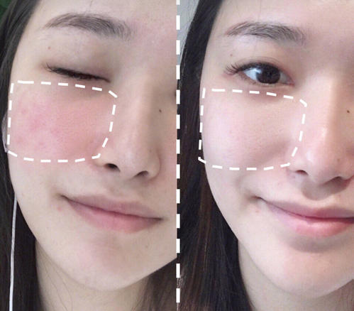 What is the water-oil balance?Tips to maintain the skin's water and oil ...