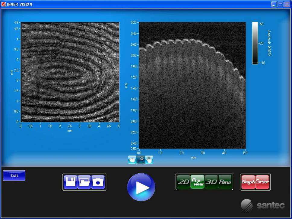 OCT imaging system - iMedia