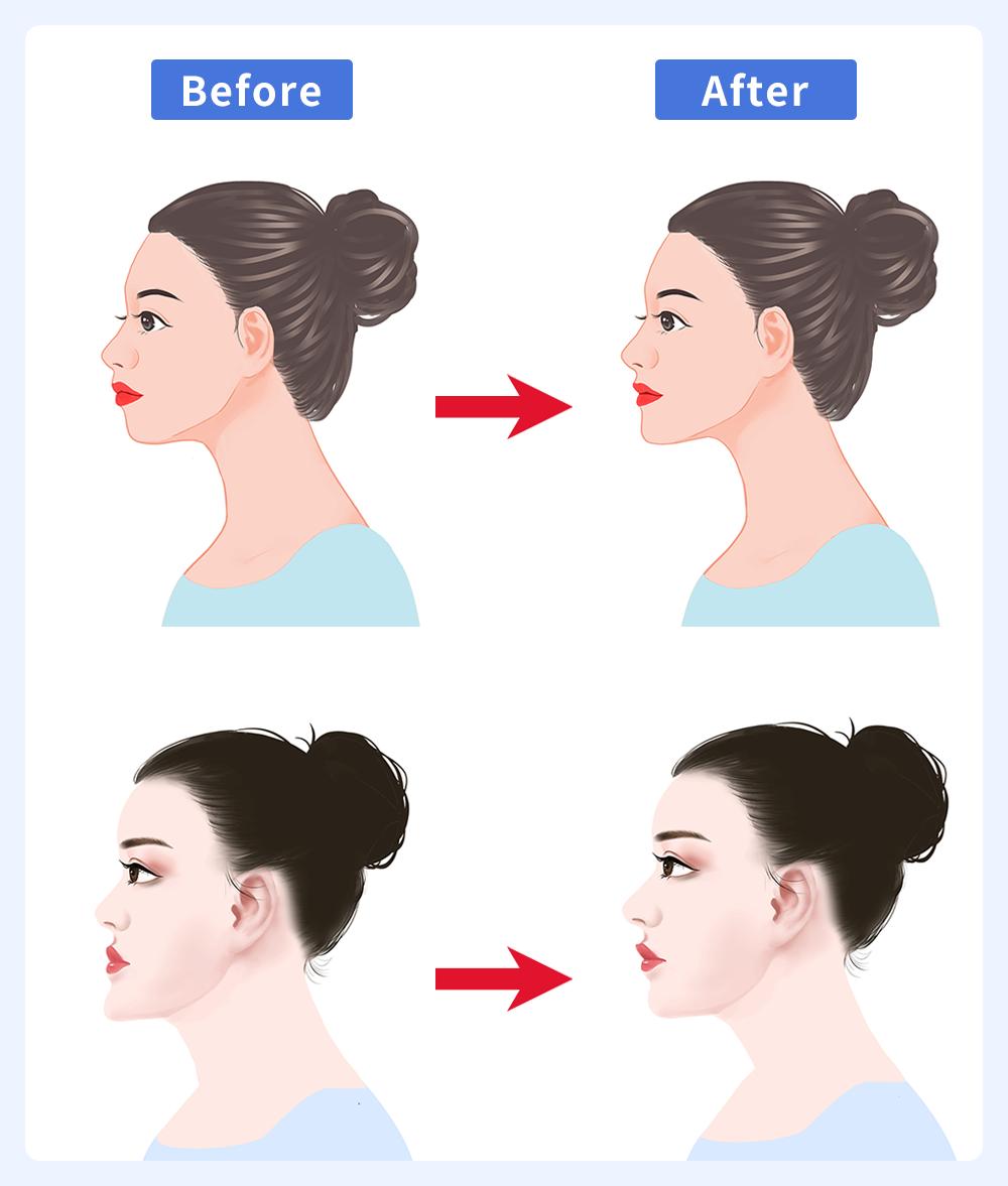 What is the most suitable age for children's orthodontics for teeth ...
