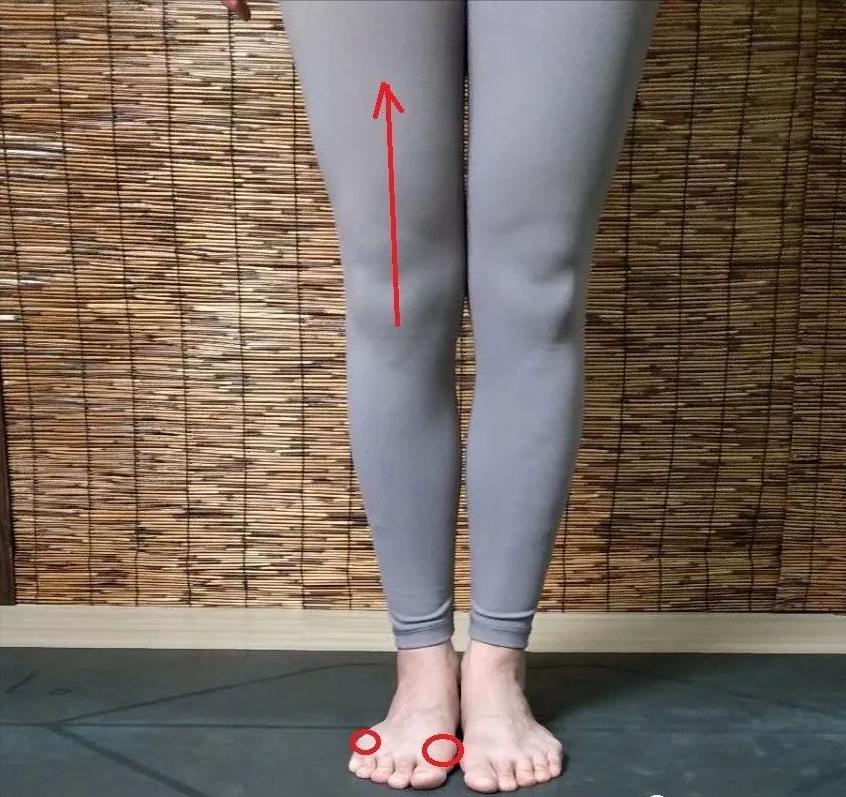 Big toe valgus causes stout legs and improper leg shape!Learn this ...