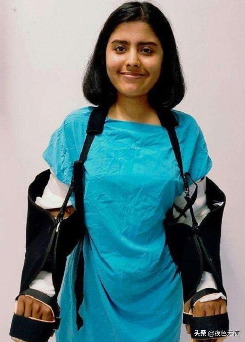 An Indian girl lost her arms in a car accident. After transplanting a ...