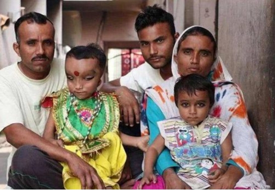 Indian deformed boy: Because he looks like a ganesha, everyone kneels ...