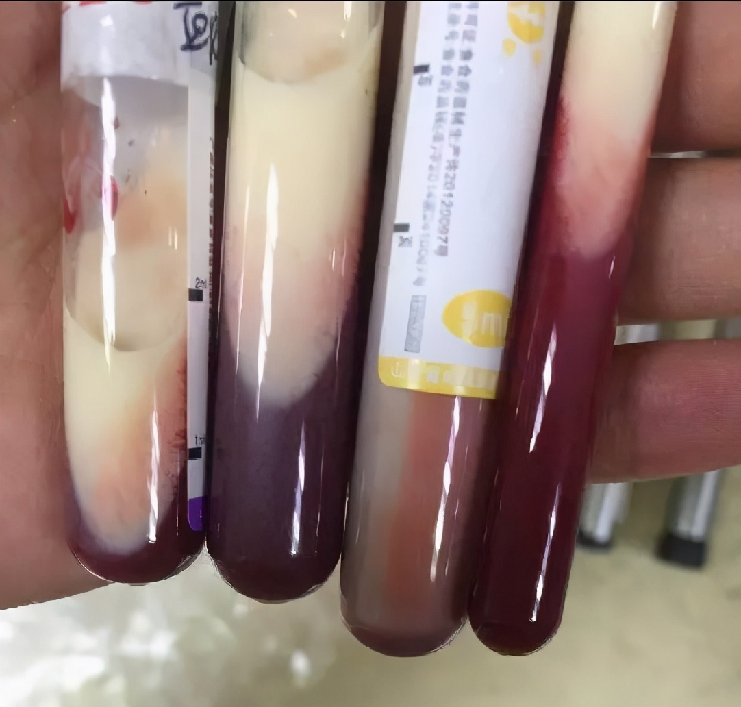 Draw blood as white as milk, tell people around you, it's dangerous ...