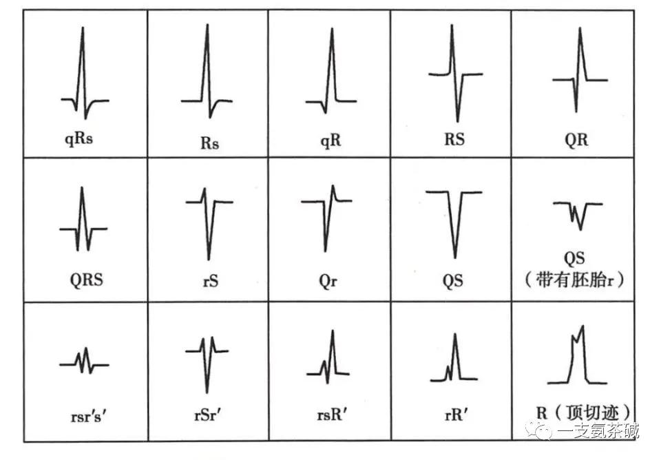 ECG Nine Nine Eighty One Difficulties Seven QRS Complexes - iMedia