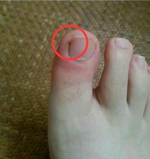 There is cancer in the body, the prophet of the legs?6 signs appear ...