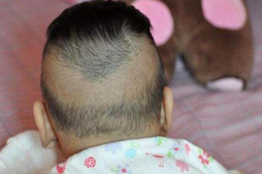 In the summer heat, can shaving my baby's head cool down?Understand the ...