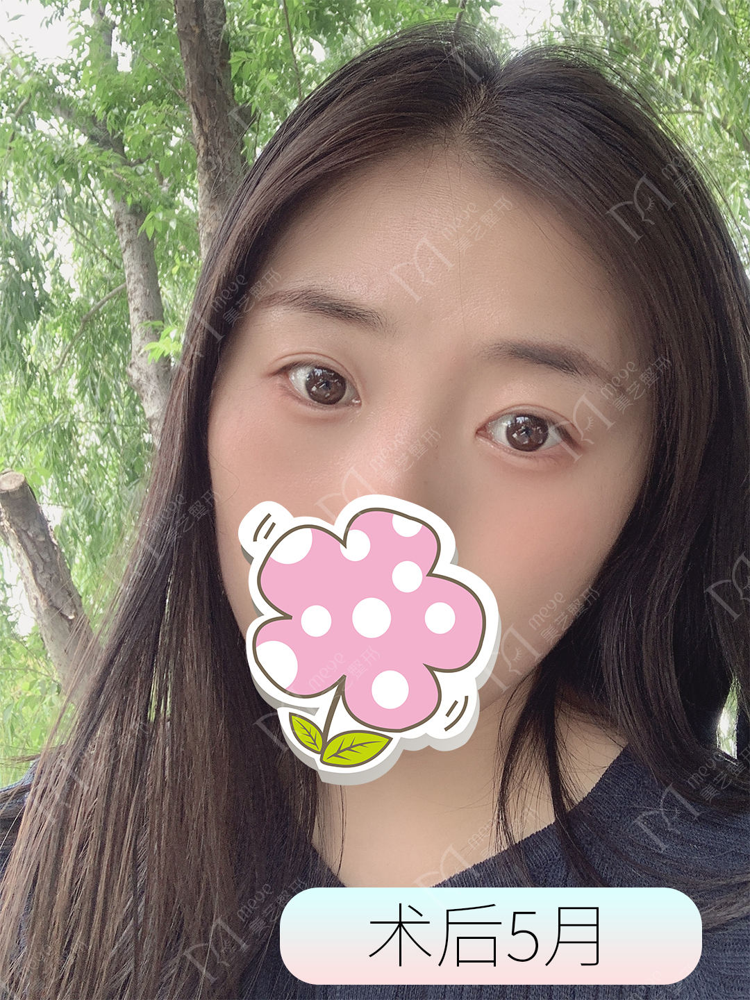 Flat fan and fan-shaped double eyelids are all natural models. How to ...