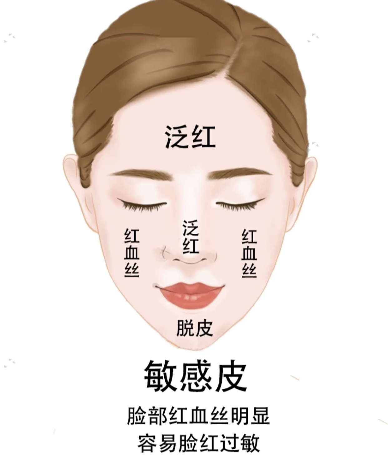 Are you really "dry skin"?Different skin types have different ...