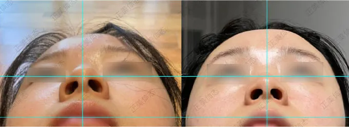 "Save the protruding cheekbones and return to the girl's face" How can ...