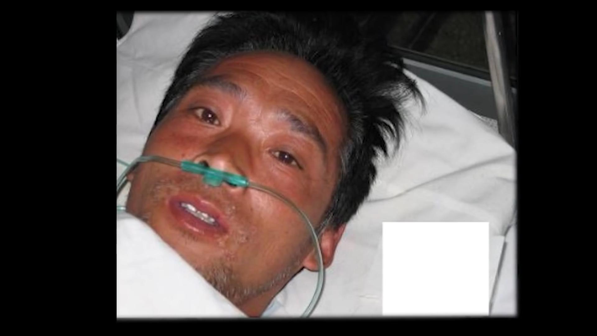 How terrible is nuclear radiation? The worst person in the world, Ouchi ...