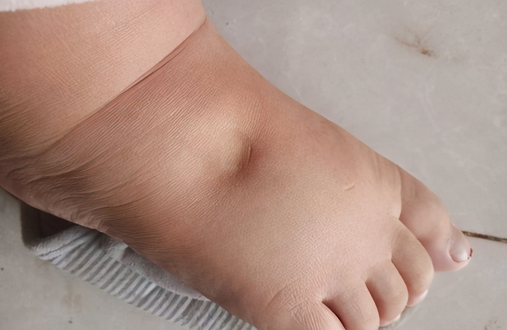 There is cancer in the body, the prophet of the legs?6 signs appear ...