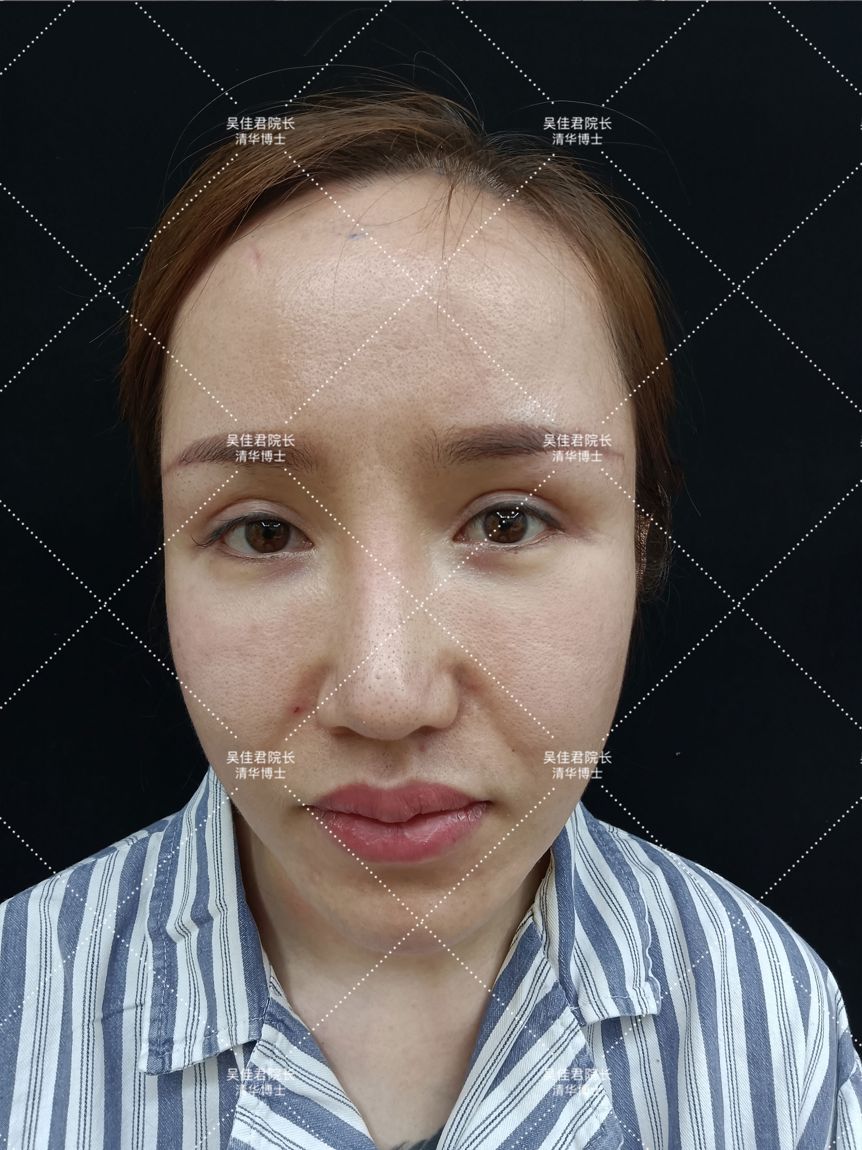 Why is she 28 years old, but she looks 10 years older than her peers ...