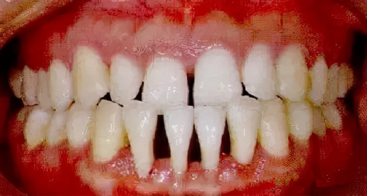 Orthodontics professor Tsai Note: How much do you know about sliced ...