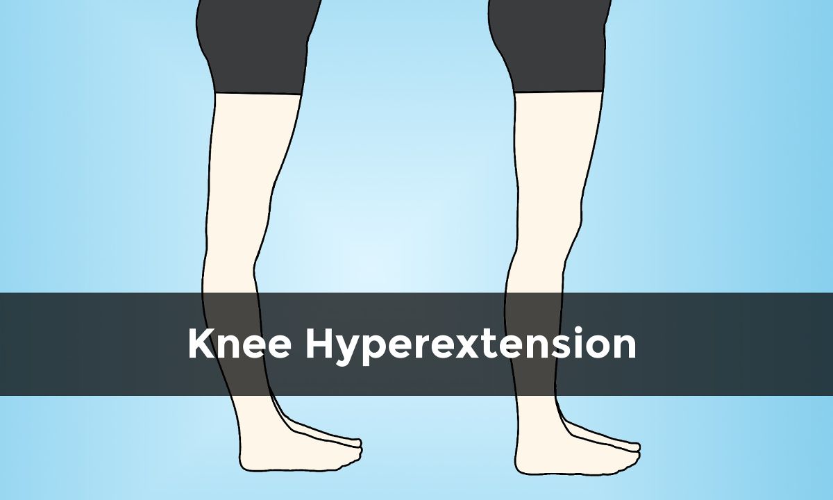 What is knee hyperextension?Many people have it, but don't know the ...