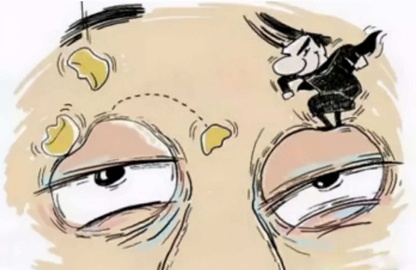 Facial twitching may not be hemifacial spasm - iMedia