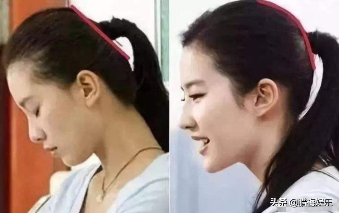 Is flat head a feature of "low appearance"?These celebrities tell you ...