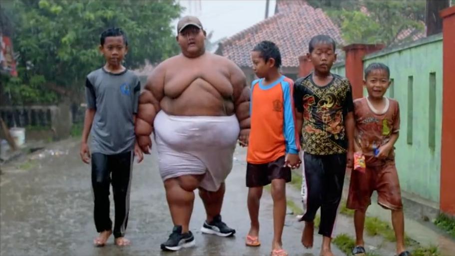 The fattest boy in Indonesia, who weighs 360 kg at 11 years old, has ...