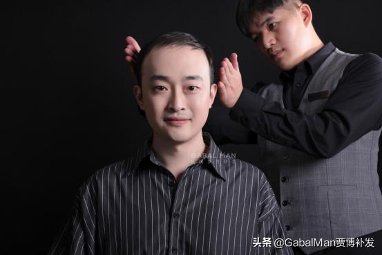 Say goodbye to the title of "Uncle Bald", start from the beginning ...