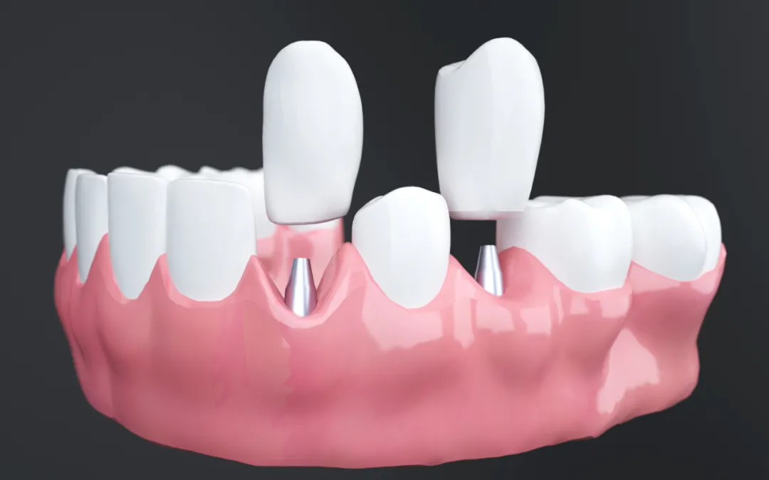 Old people often do this, and they can have good teeth at the age of 80 ...