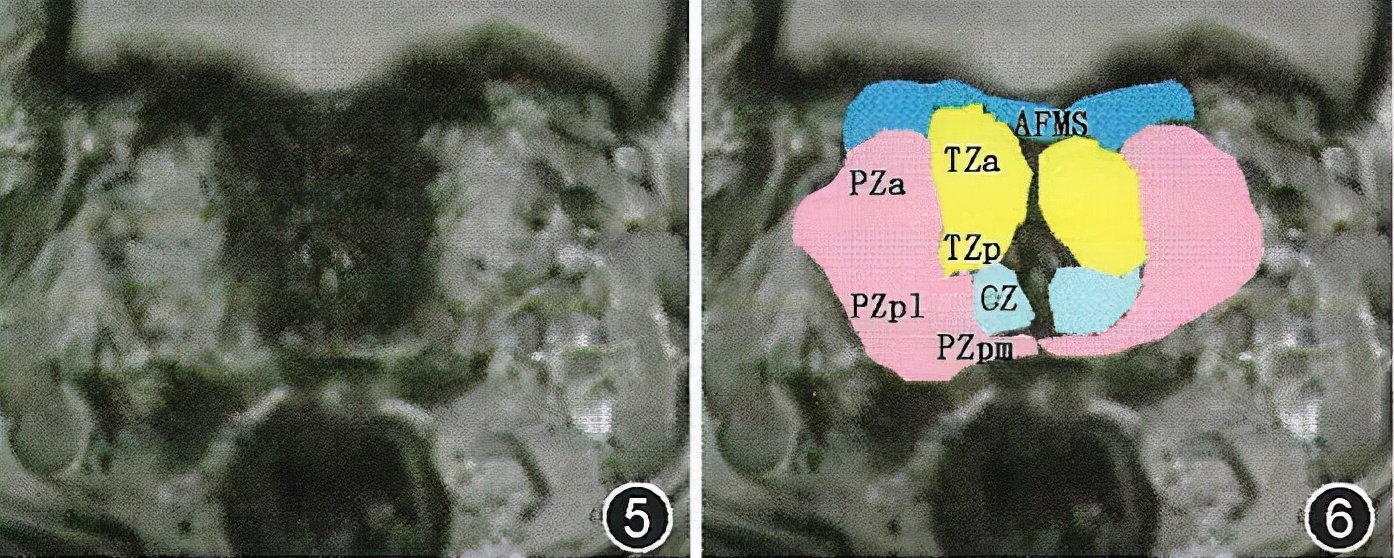 Prostate MRI Anatomy Division - iMedia