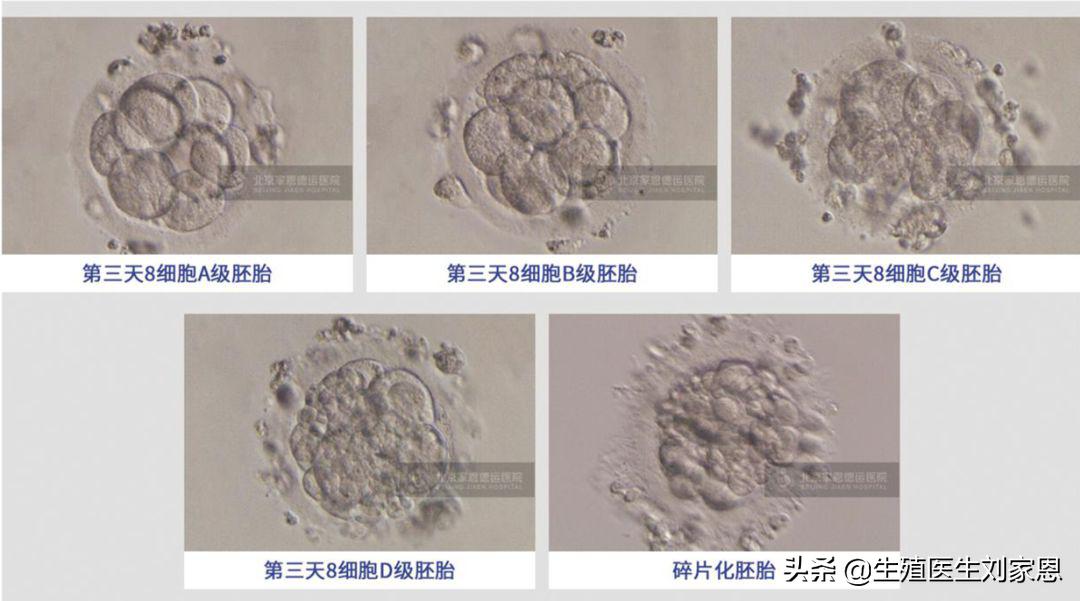 What do embryos of different grades look like?What does 2A2B1C mean?I ...