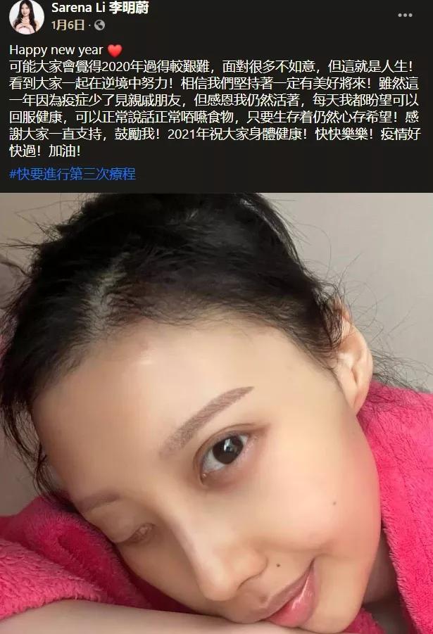 Li Mingwei, a 31-year-old singer, died of cancer and was disfigured by ...