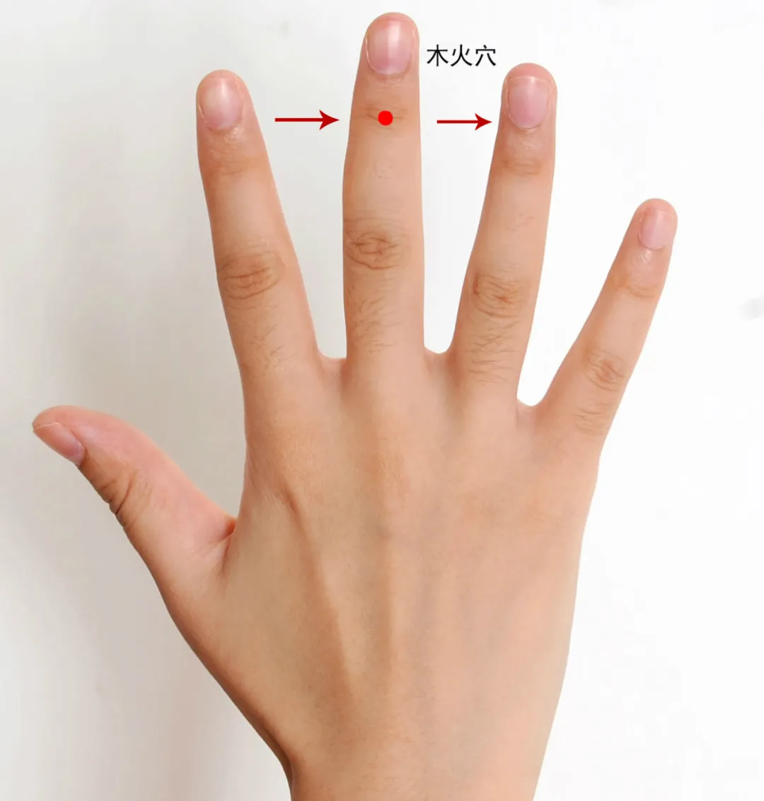 TCM experts shouted "Don't go crazy after stroke", acupuncture and ...