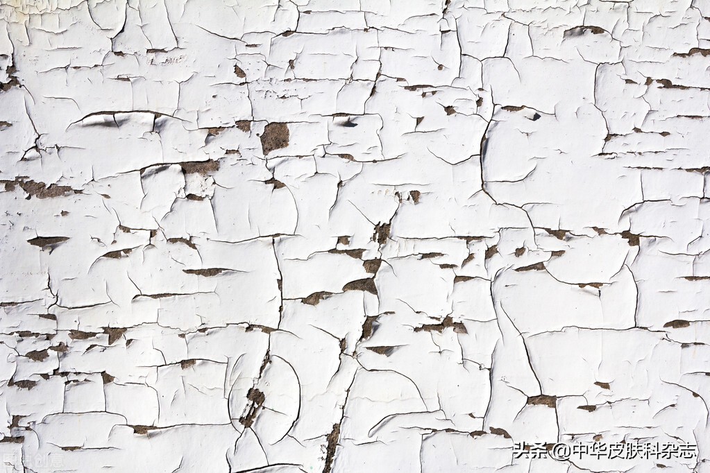 Toad skin disease, pellagra, mangy skin disease, ichthyosis, what are ...