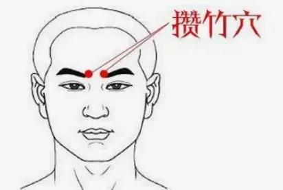 What is the reason for "Yintang is black"?Chinese medicine makes it ...