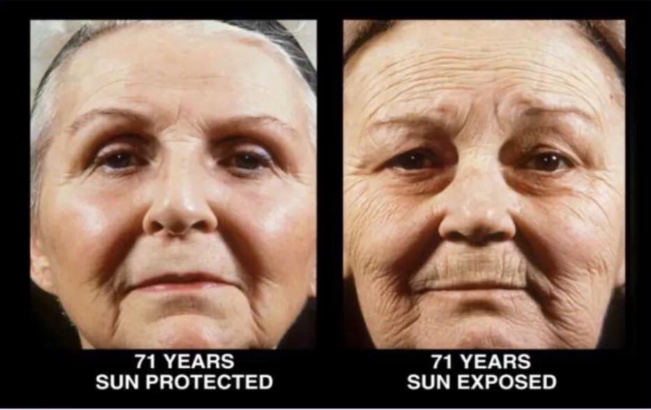 Causes of skin aging-about photoaging - iMedia