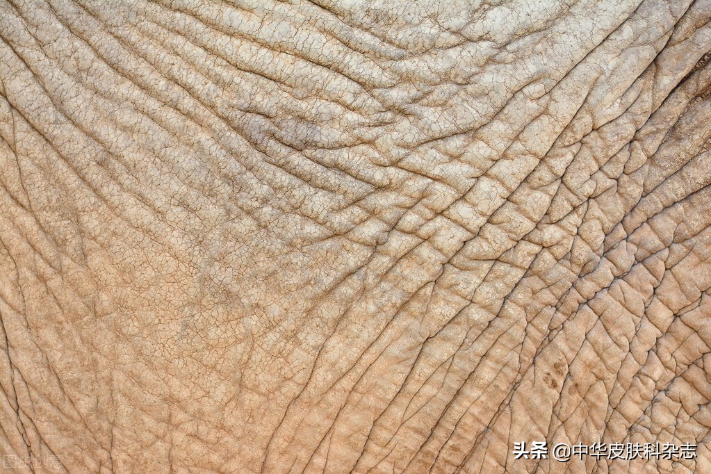 Toad skin disease, pellagra, mangy skin disease, ichthyosis, what are ...