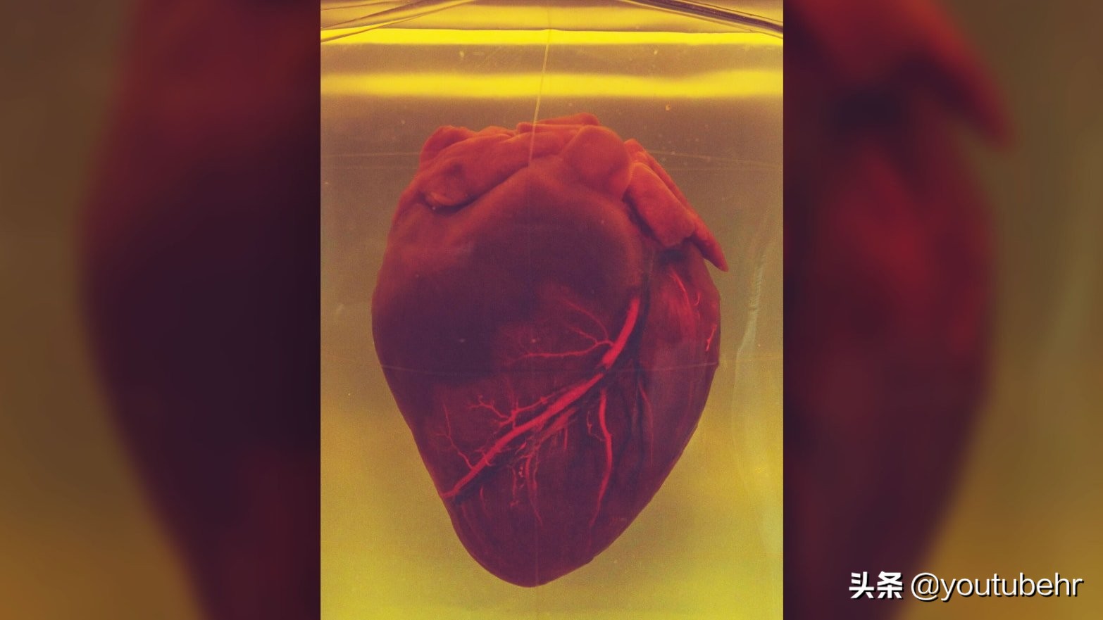 These tiny human hearts could help solve the organ transplant crisis ...